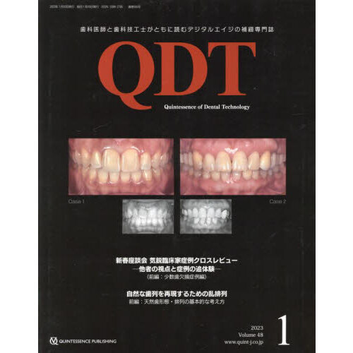 QDT 48－1 通販｜セブンネットショッピング